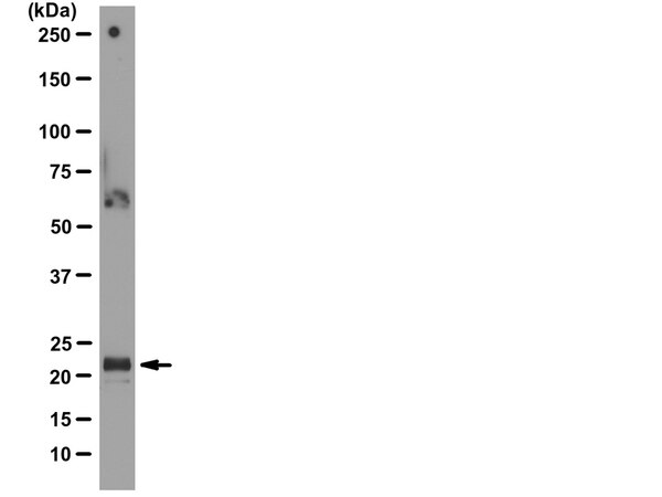 Anti-ASC Antibody, clone 2EI-7 | 04-147